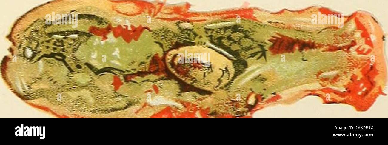 Modern surgery, general and operative . .X3** Various forms of ...