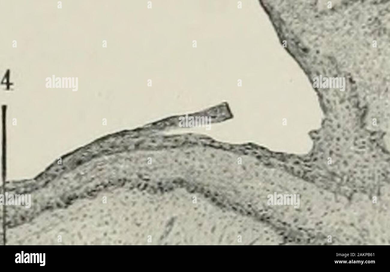 American practice of surgery : a complete system of the science and art ...