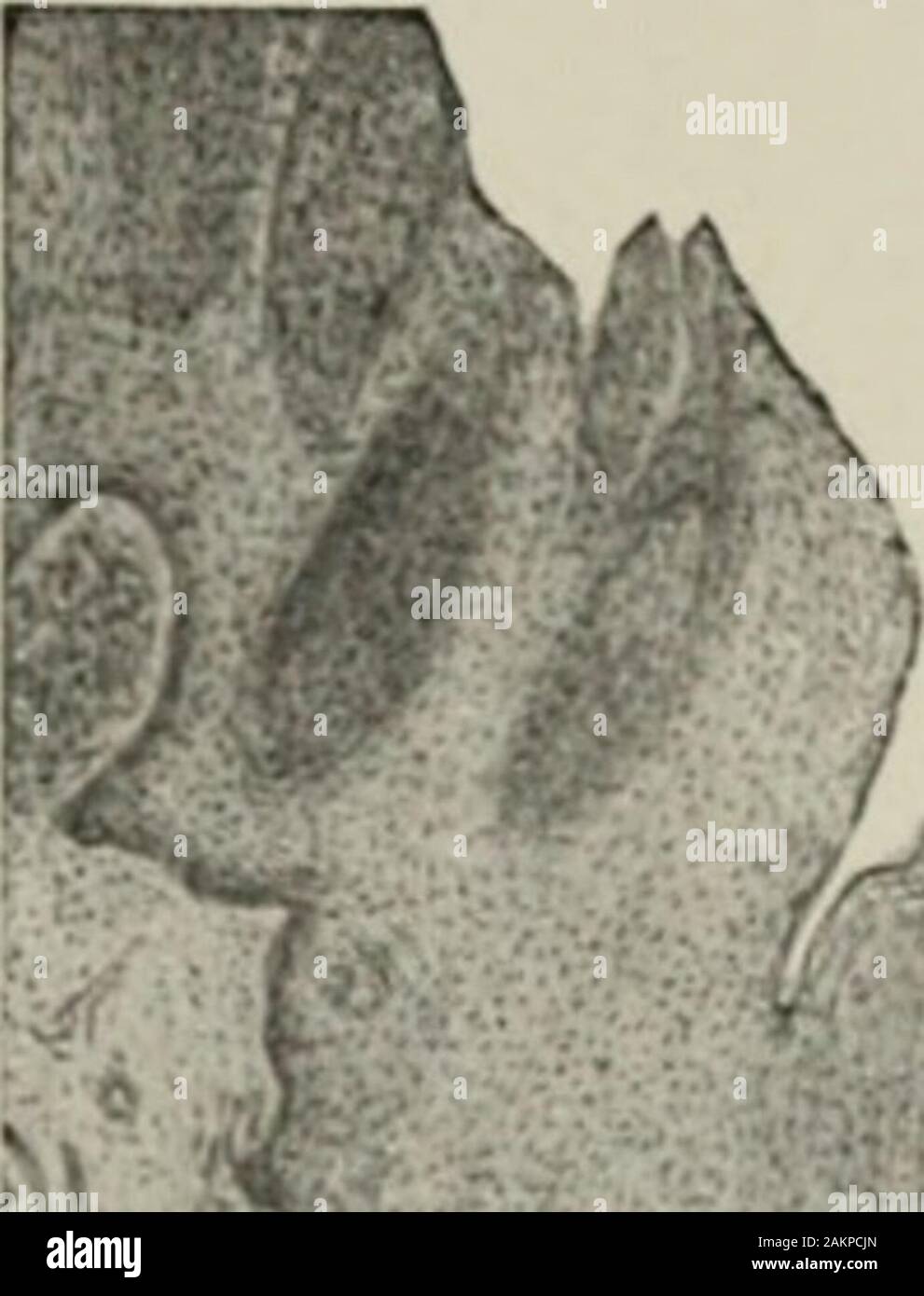 American practice of surgery : a complete system of the science and art ...