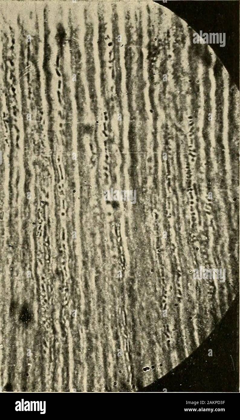 Principles and practice of operative dentistry . Fig. 290.—Longitudinal ...