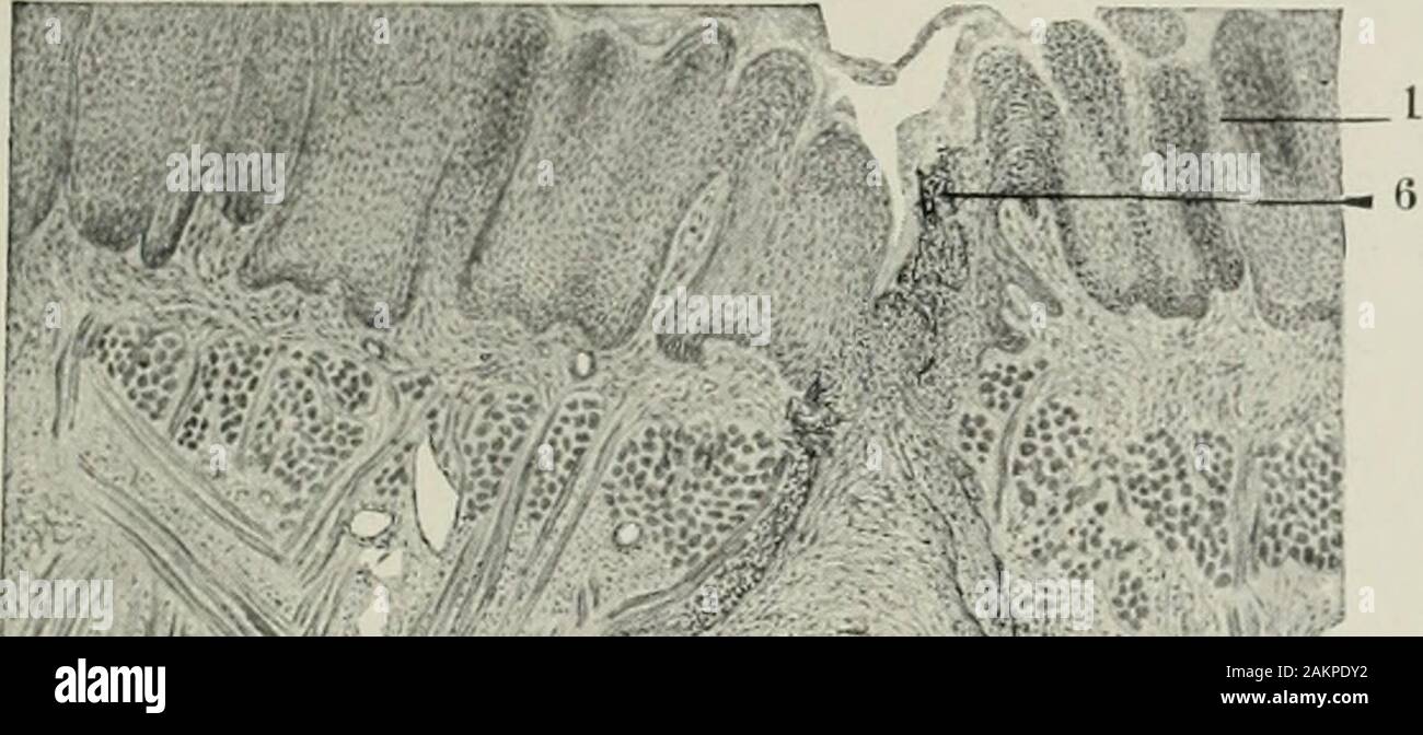 Granulation tissues hi-res stock photography and images - Alamy