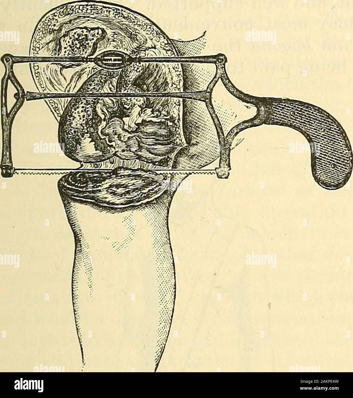 Horizontally saw hi-res stock photography and images - Alamy