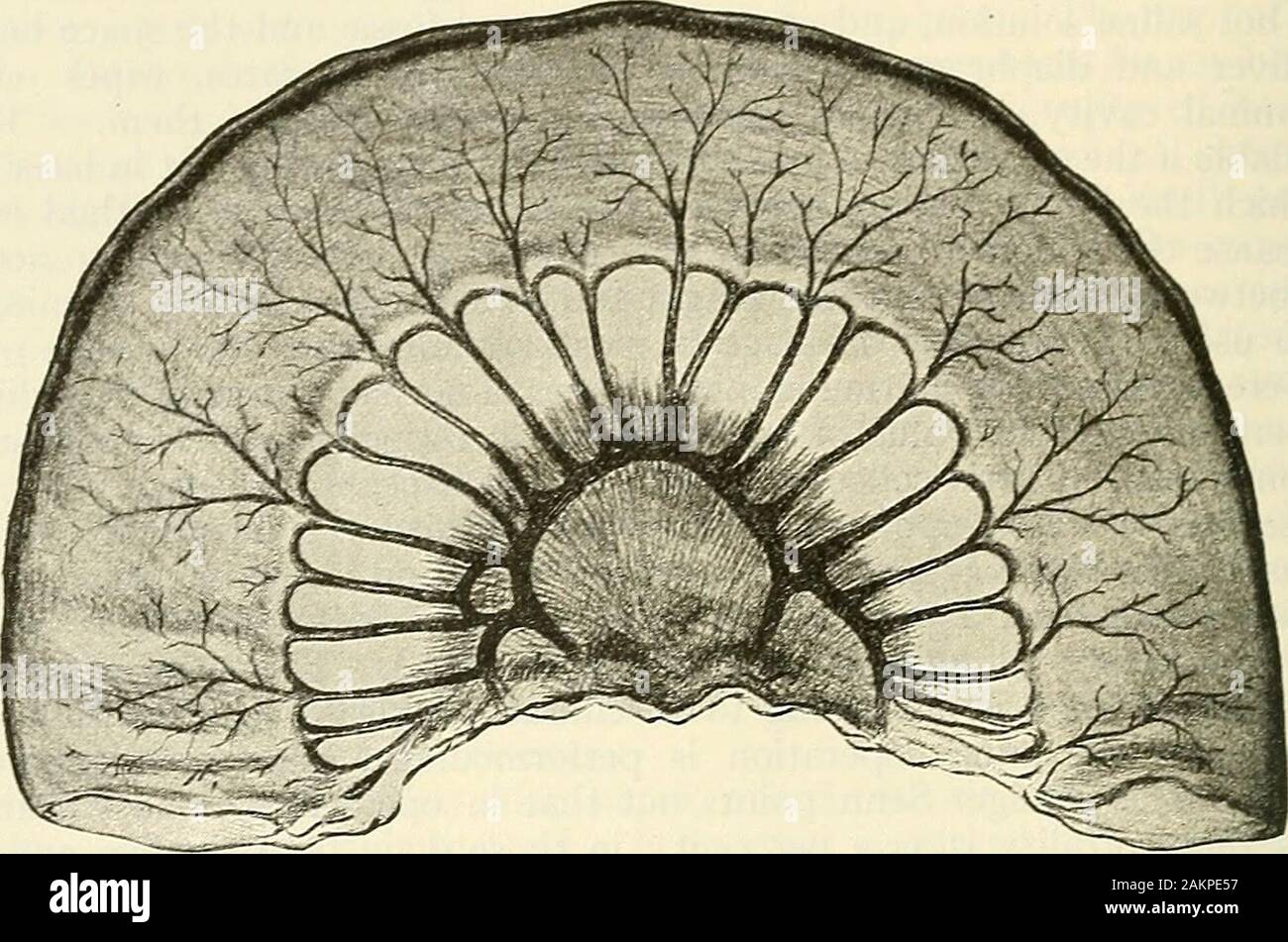 Inverted Y Perineal Incision Deepened Through
