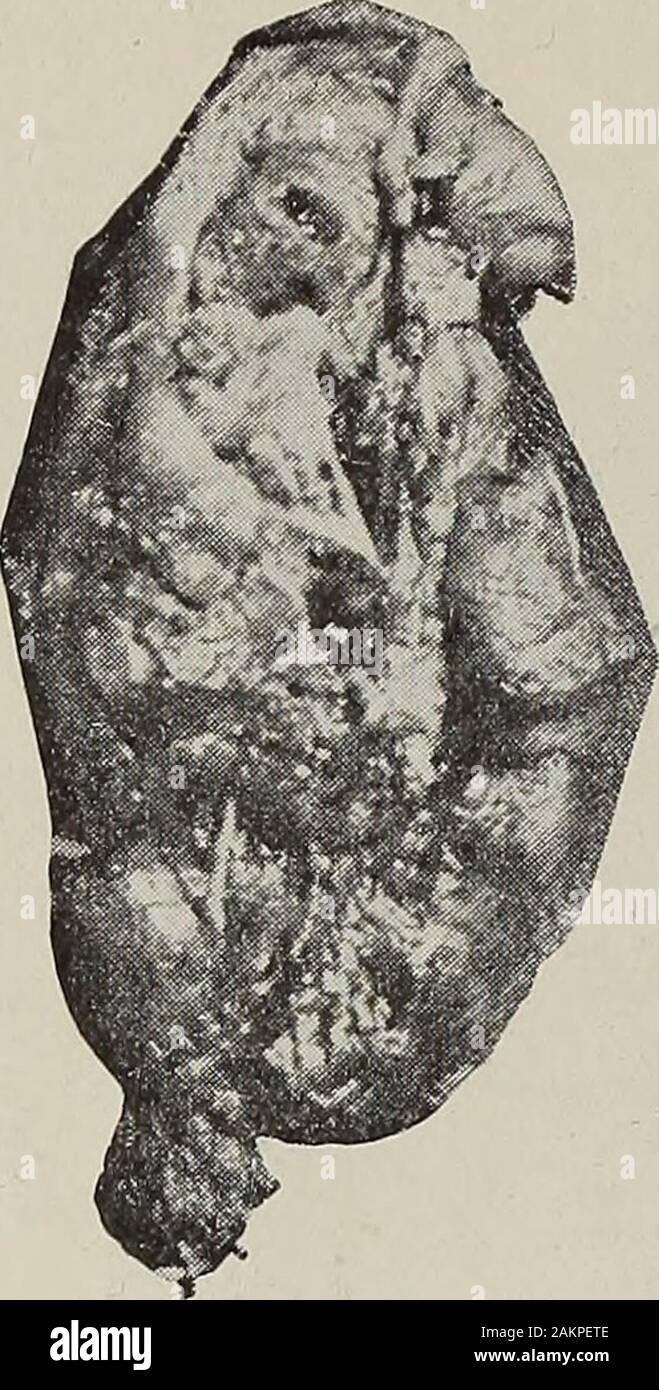 The archives of physiological therapy . ii8 THE DENSITY OF CALCULI. Fig ...
