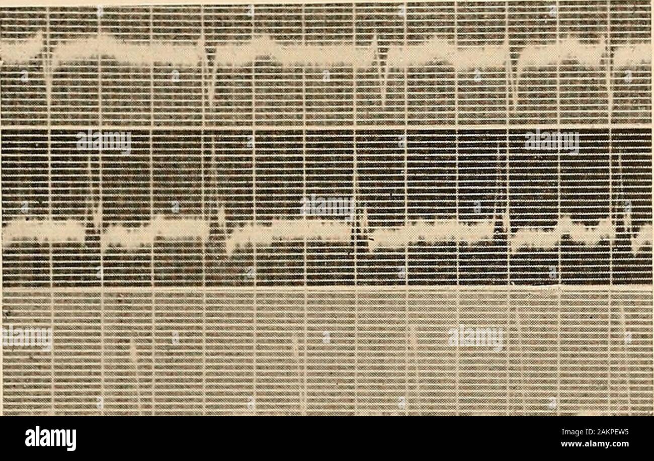 Clinical electrocardiography . Fig. 127.—Electrocardiogram of patient ...