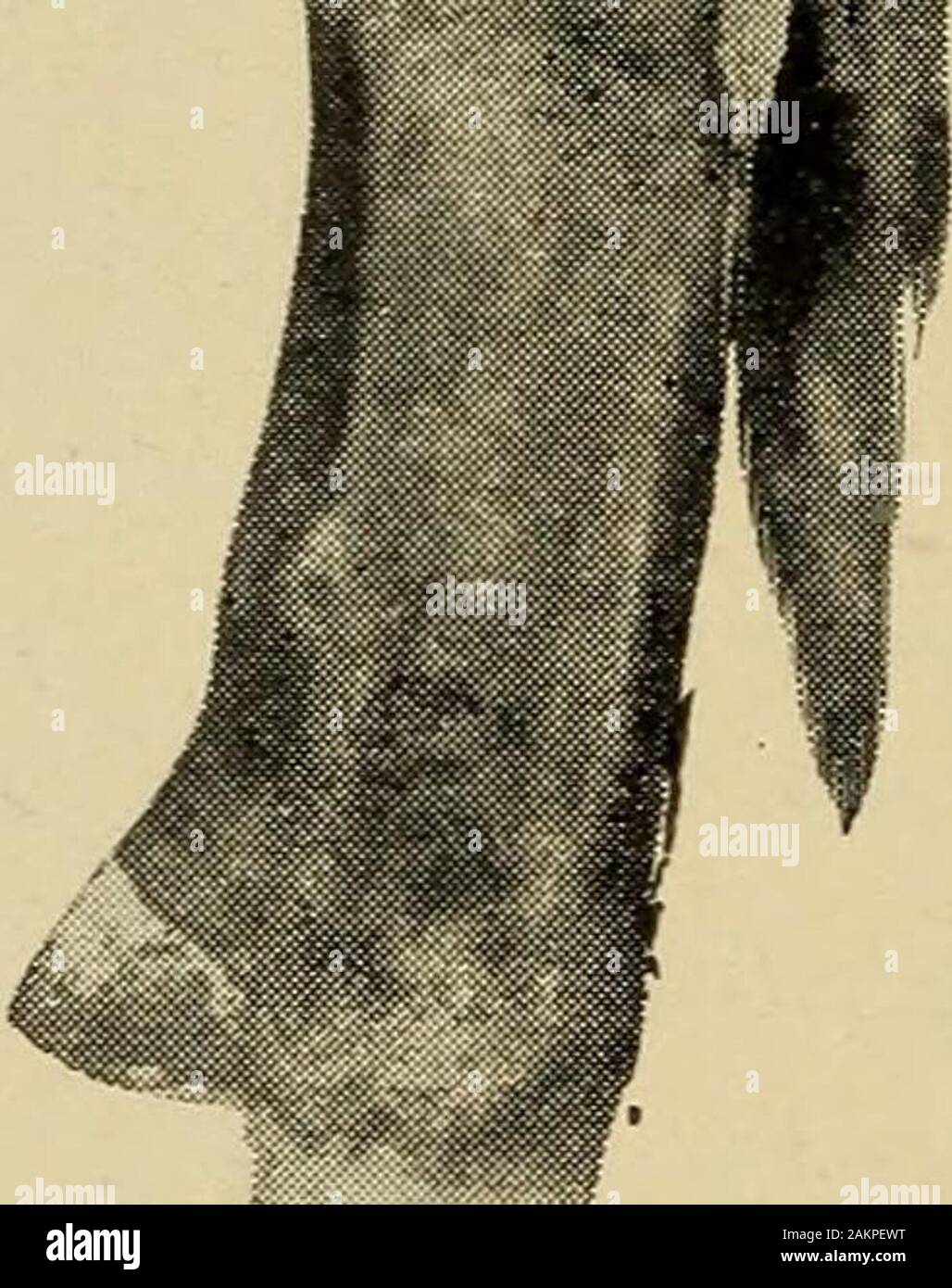 Calcaneo posterior hi-res stock photography and images - Alamy