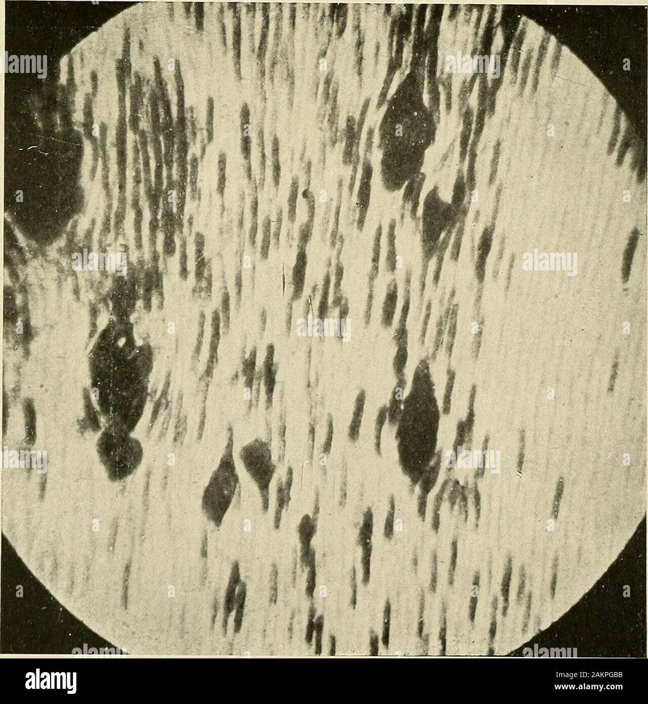 Principles and practice of operative dentistry . Fig. 2S1.—Vertical ...