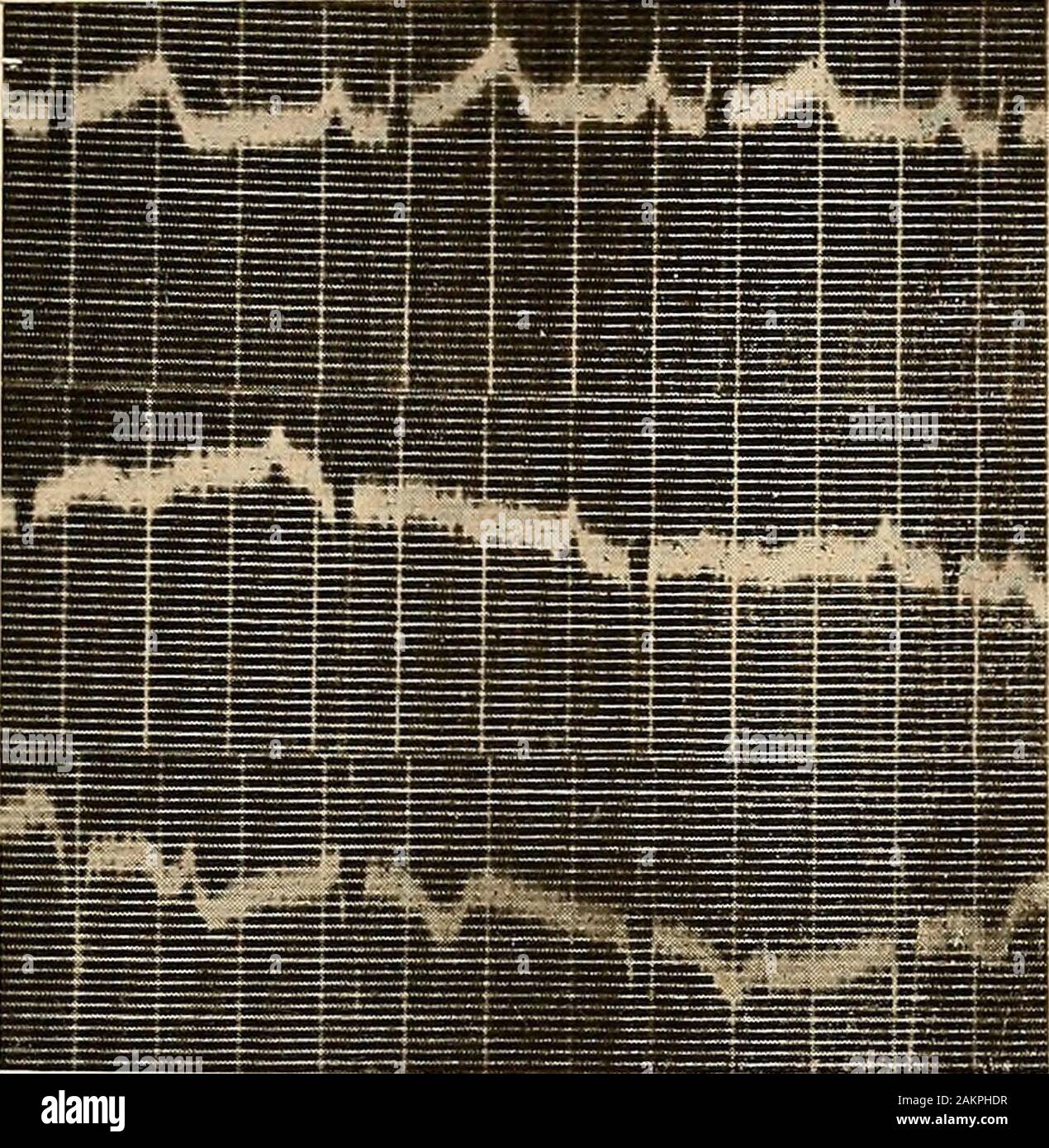 Fetal defects hi-res stock photography and images - Alamy