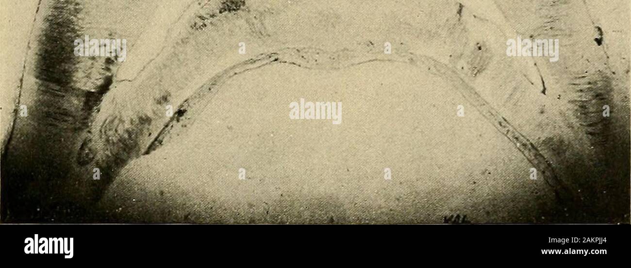 Principles and practice of operative dentistry . Fig. 272.—Vertical ...