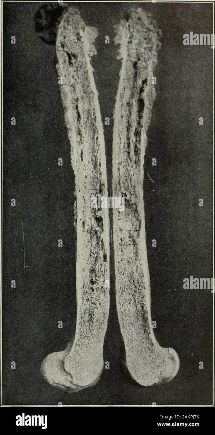 American practice of surgery : a complete system of the science and art ...