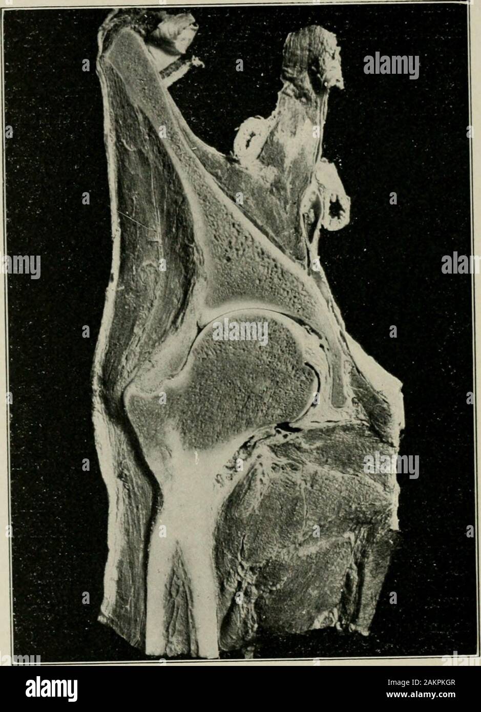 Cotyloid ligament hi-res stock photography and images - Alamy
