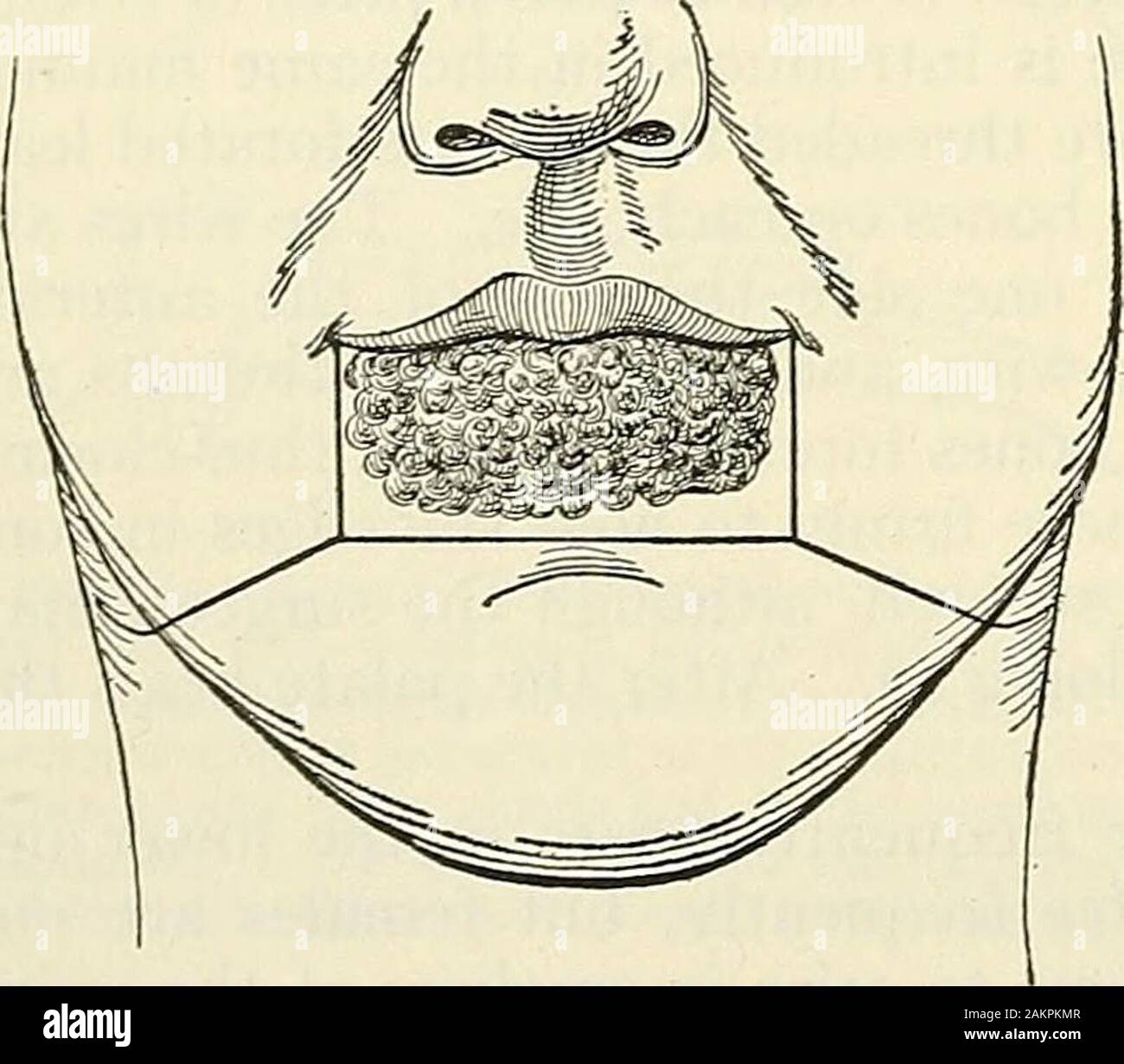 Modern incisions hi-res stock photography and images - Alamy