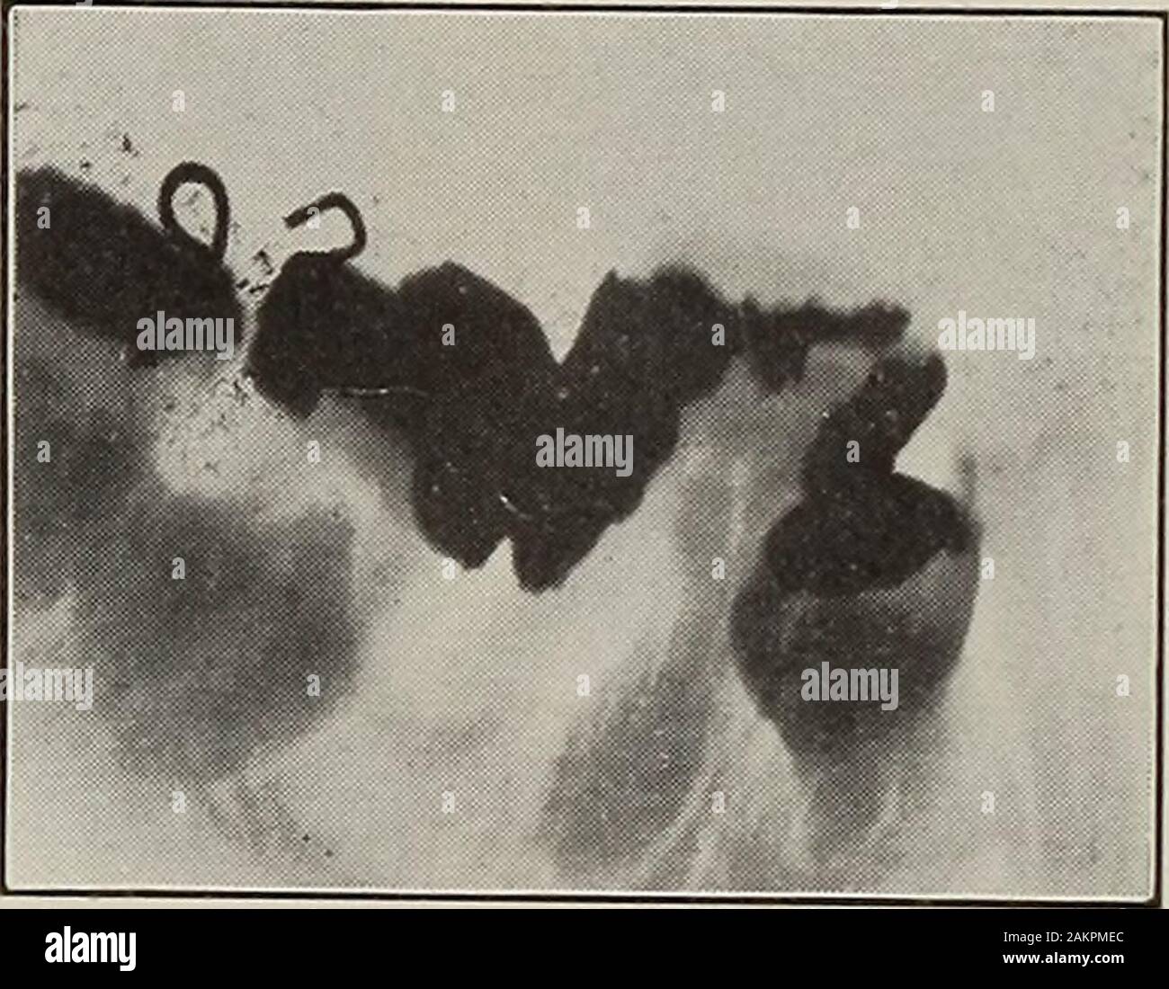 The archives of physiological therapy . Figure 17 Figure 19 Figure 13 ...