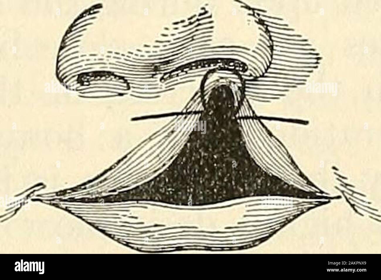 Modern surgery general operative hi-res stock photography and images ...