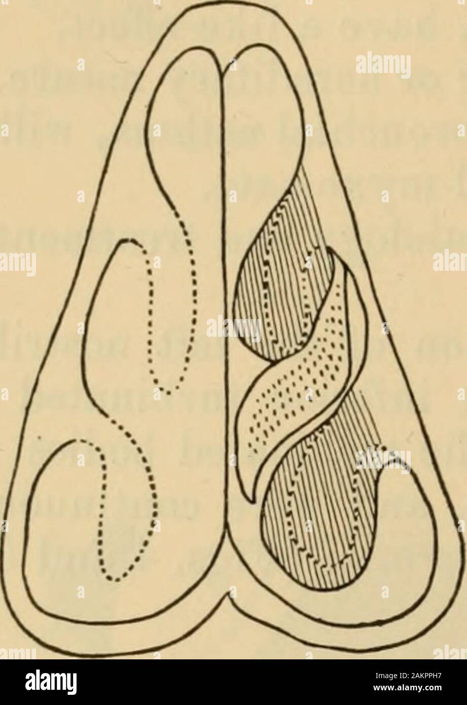 Obstruction vision hi-res stock photography and images - Alamy