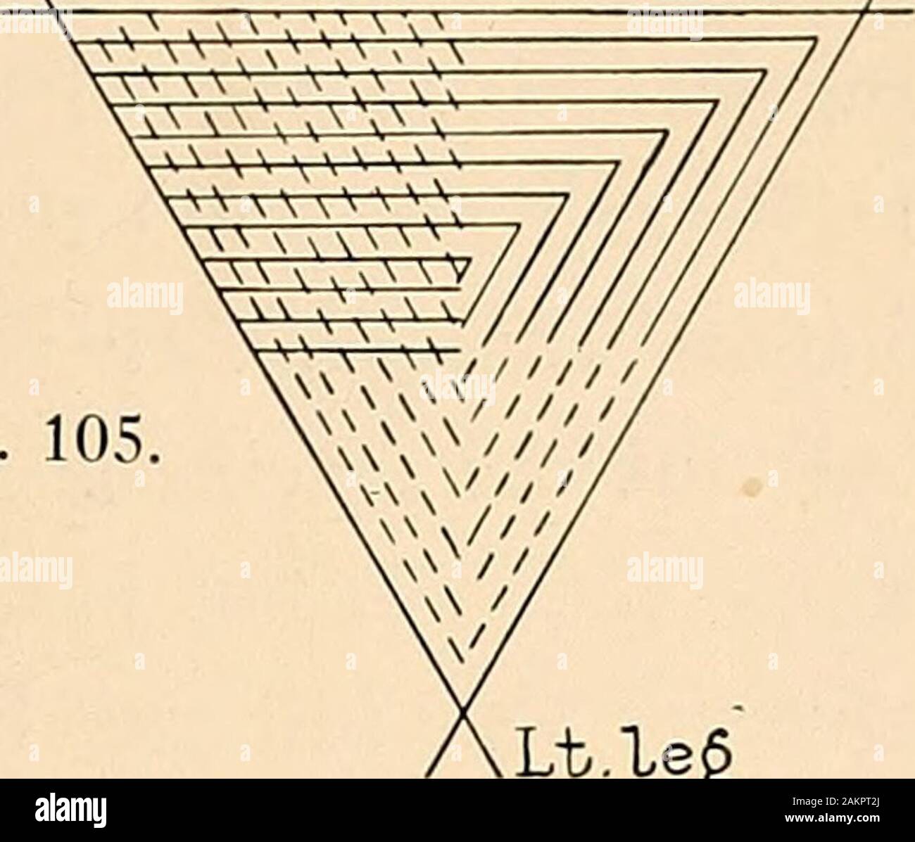Clinical electrocardiography . Fig. 104 Negative T wave in, Derivations ...