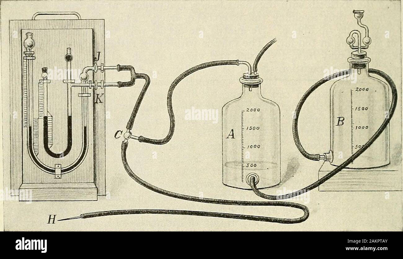 Pleural catheter hi-res stock photography and images - Alamy