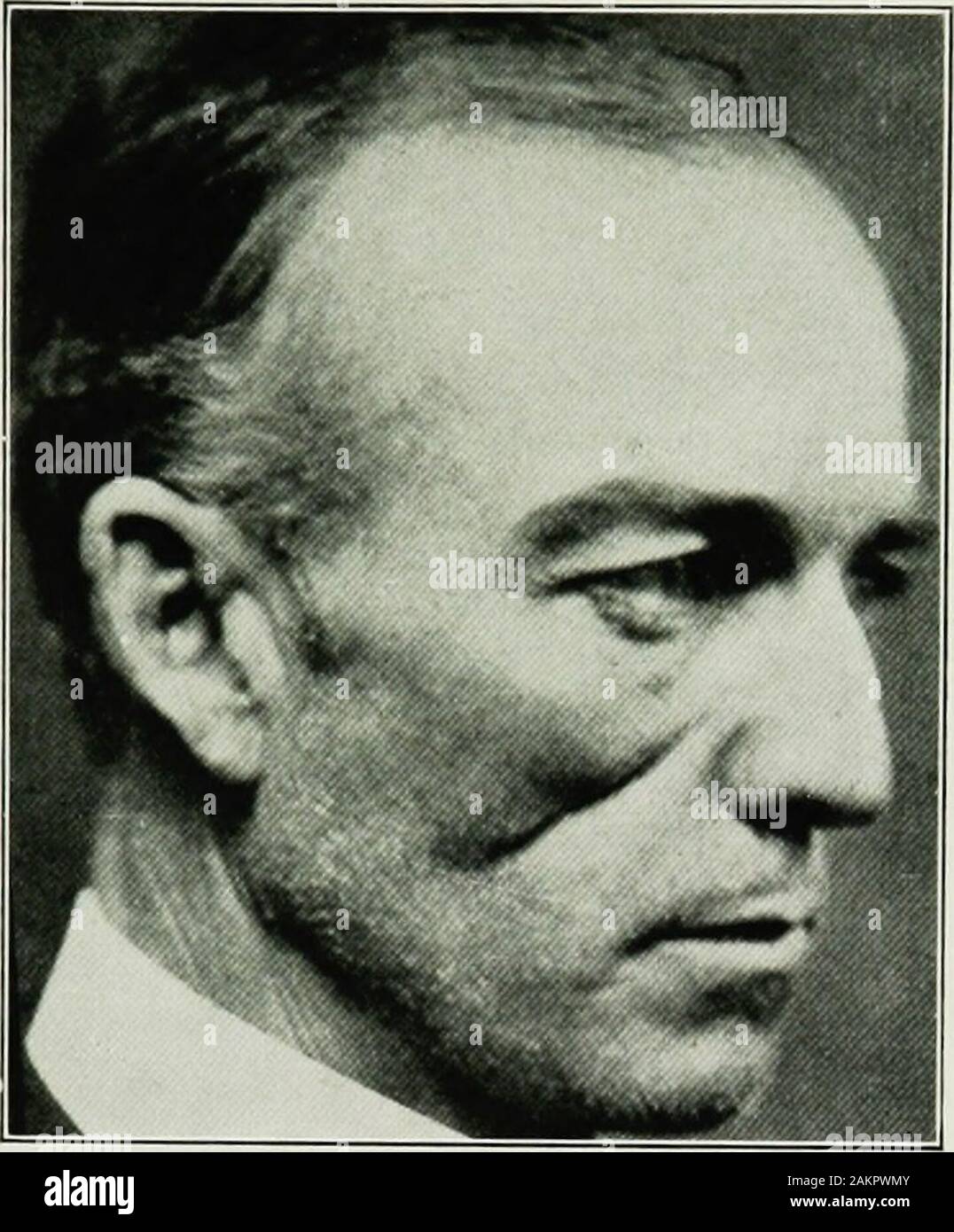 Necrosis after injury hi-res stock photography and images - Alamy