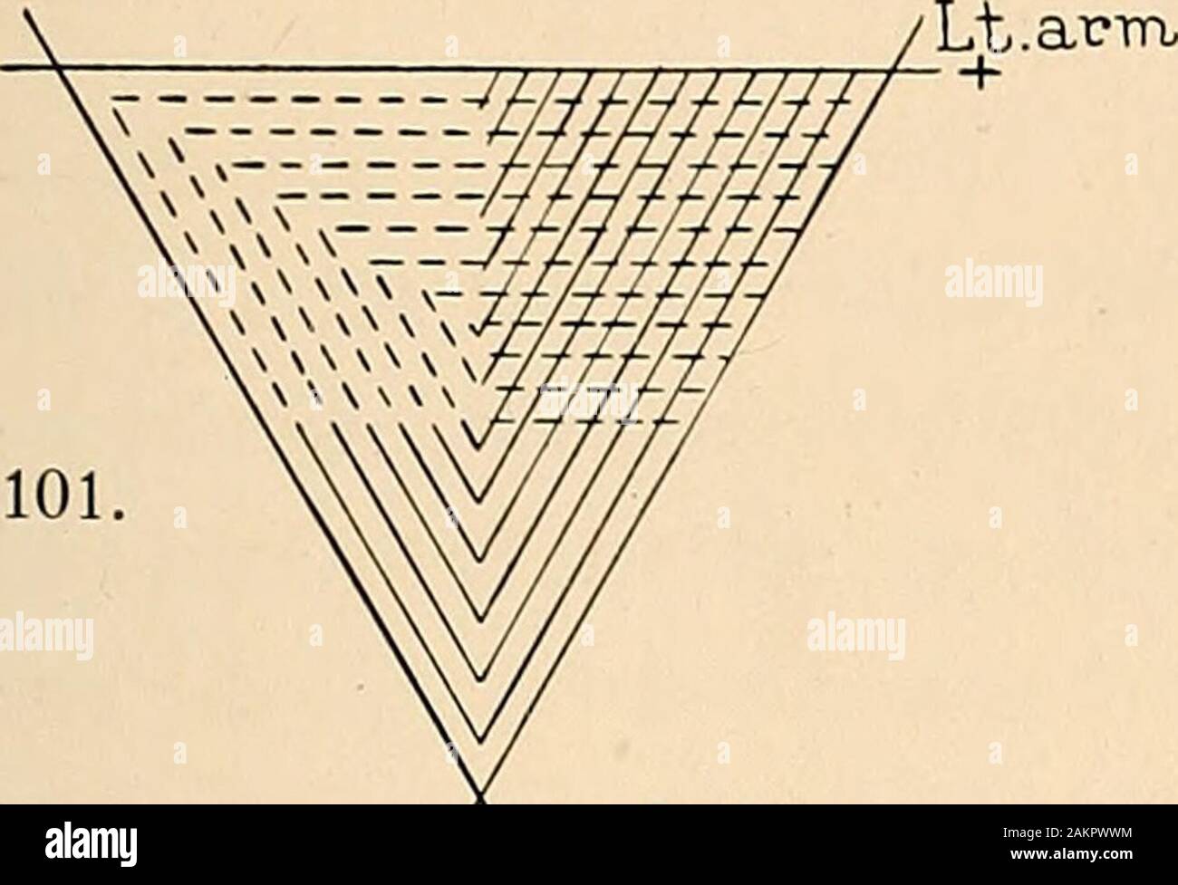 Clinical electrocardiography . ation III,left arm —, left leg + (Fig ...