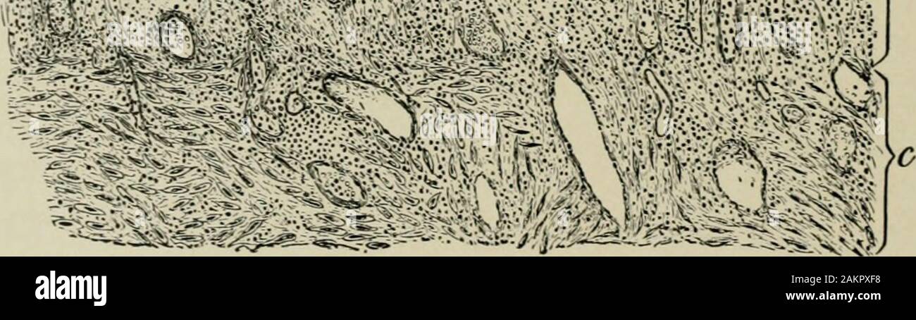 Ulcer Base High Resolution Stock Photography and Images - Alamy