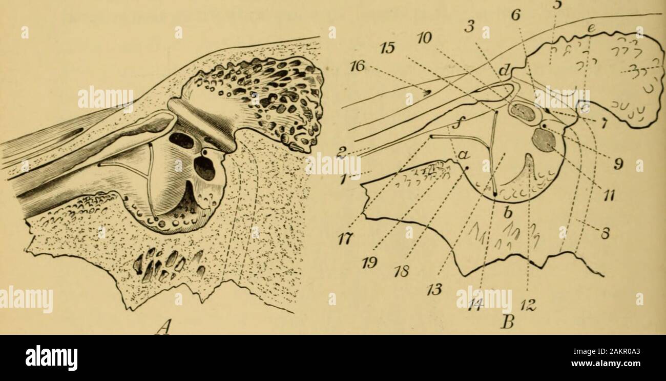 A treatise on the diseases of the ear including the anatomy and ...