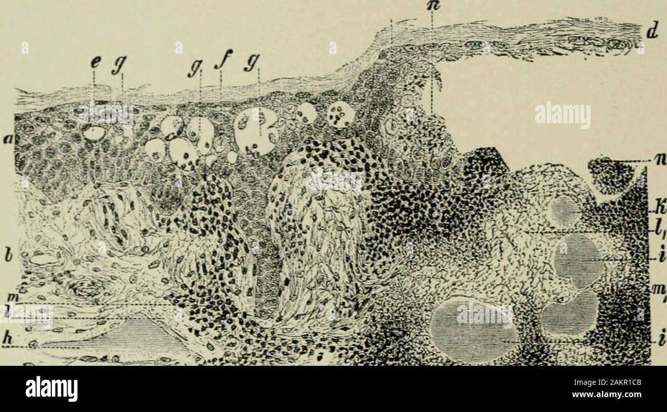 Granulation tissues hi-res stock photography and images - Alamy