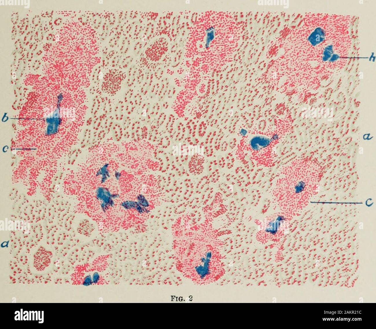 American practice of surgery : a complete system of the science and art ...