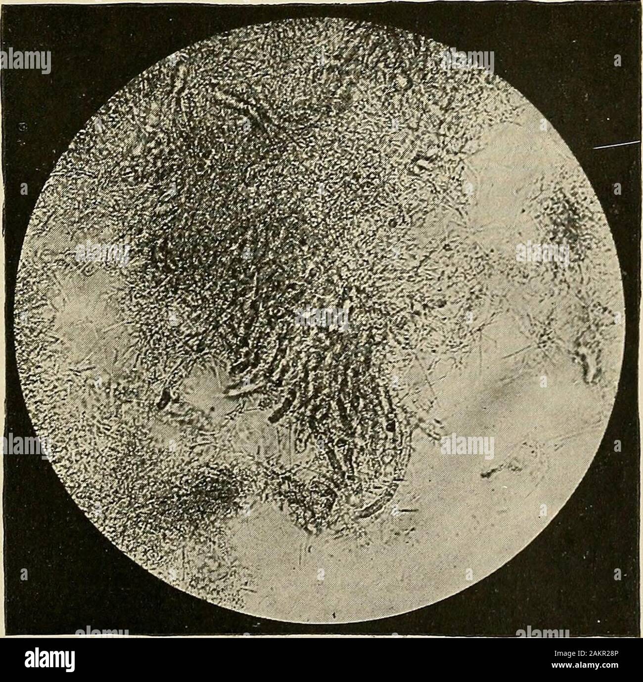 Gelatinous solution hi-res stock photography and images - Alamy