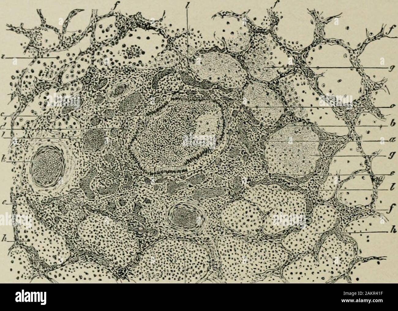 Phlegmonous hi-res stock photography and images - Alamy