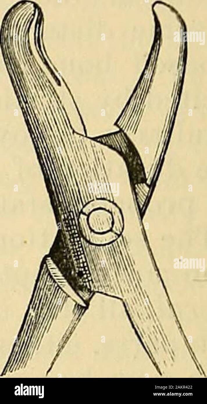 The science and art of surgery : being a treatise on surgical injuries ...