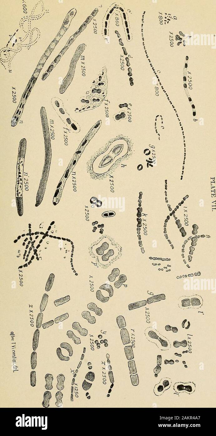 Salivary calculus hi-res stock photography and images - Alamy