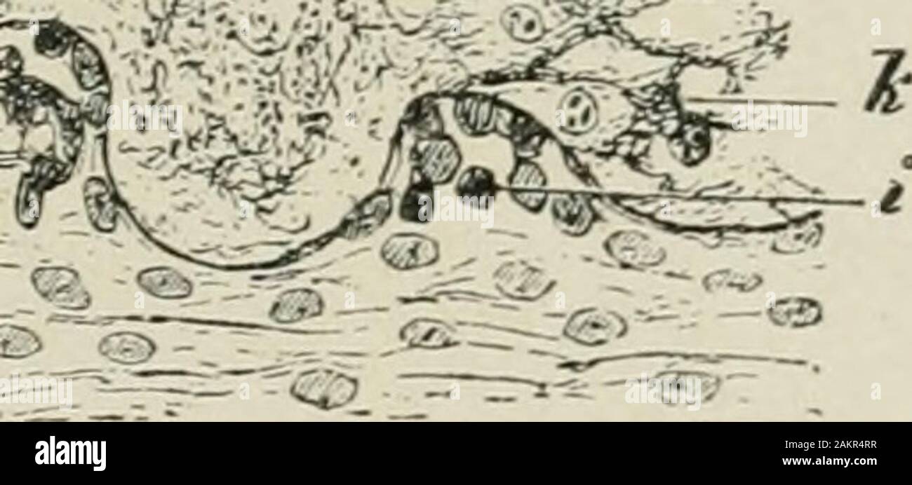 Bum surgery hi-res stock photography and images - Alamy