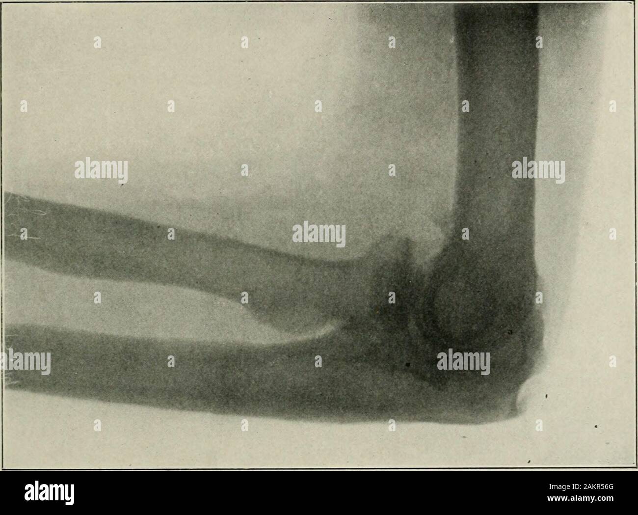 Have a non art function hi-res stock photography and images - Alamy