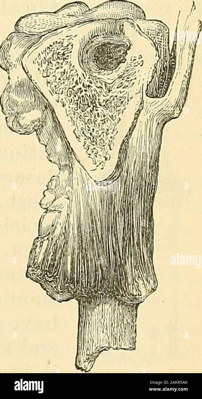 The science and art of surgery : being a treatise on surgical injuries ...