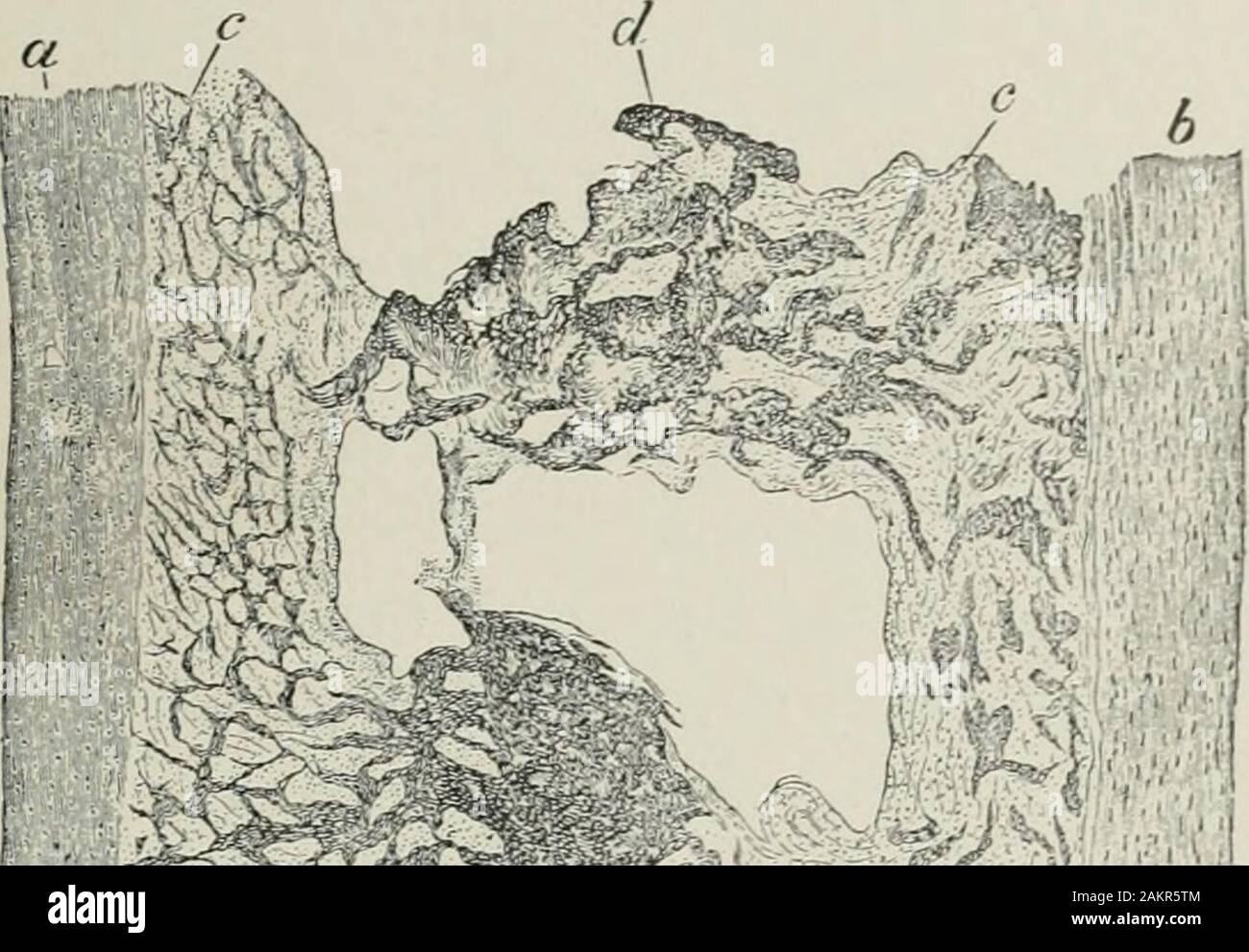 American practice of surgery : a complete system of the science and art ...