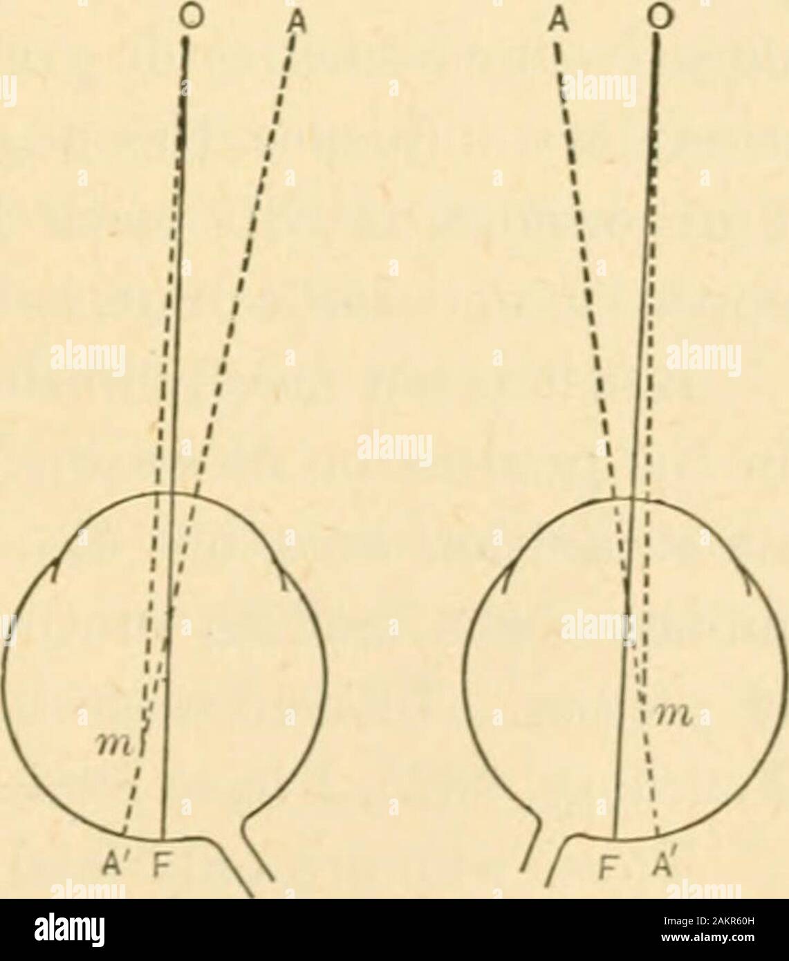 The refraction of the eye; including a complete treatise on ...