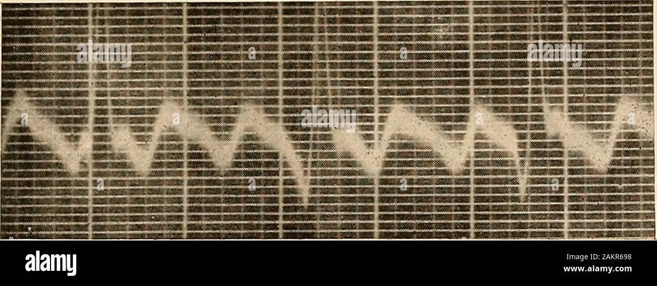 Clinical electrocardiography . low of blood. Mackenzies observa-tions ...