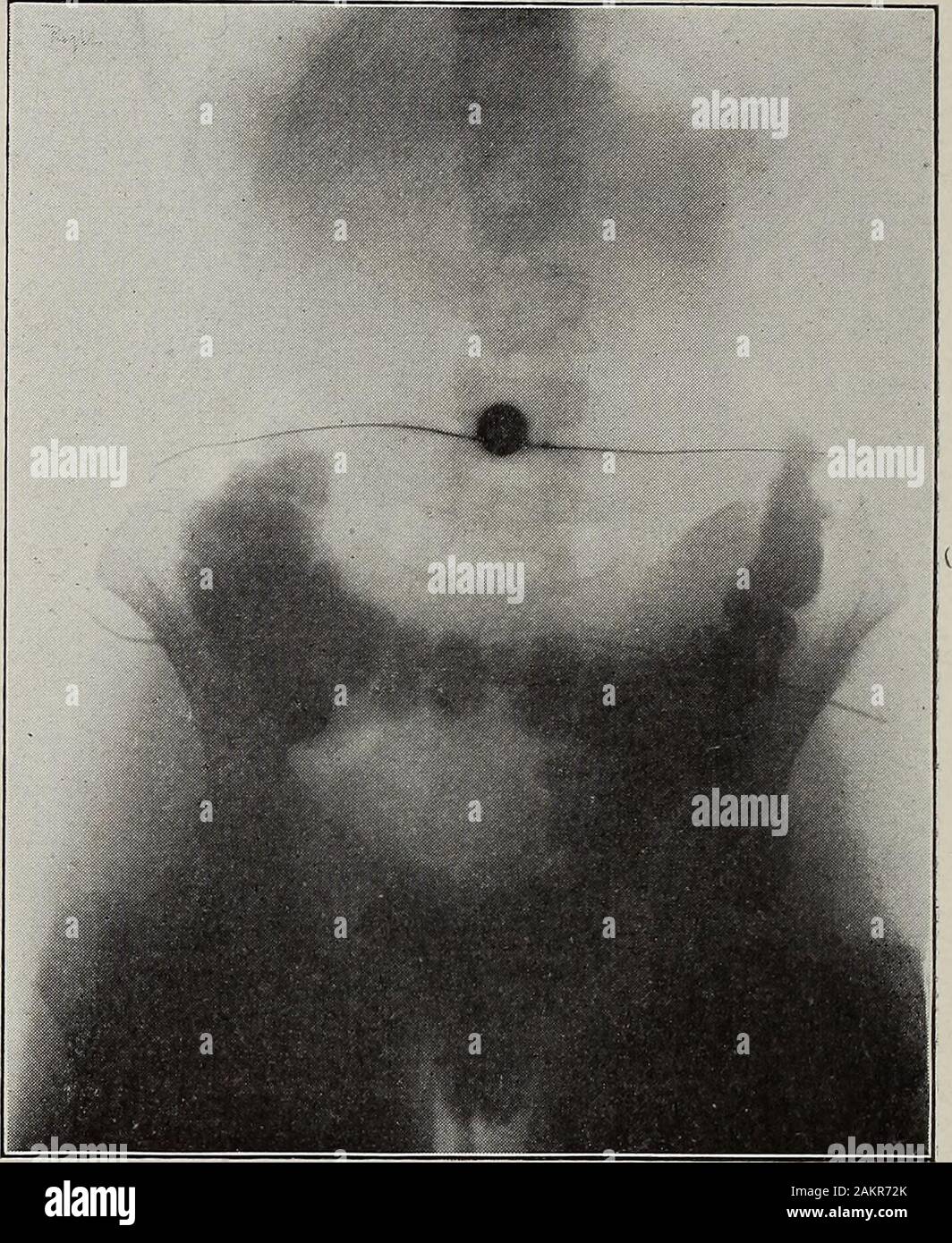 The archives of physiological therapy . Fig. 6. Mrs. M. Stereoscopic ...