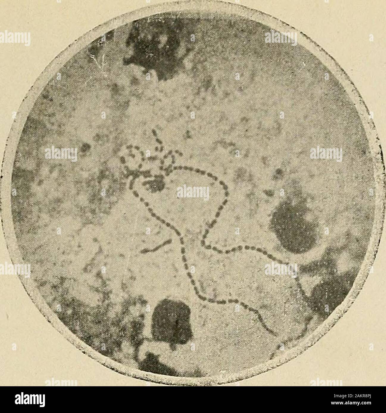 Principles and practice of operative dentistry . Fig. 233.—Diplococcus ...