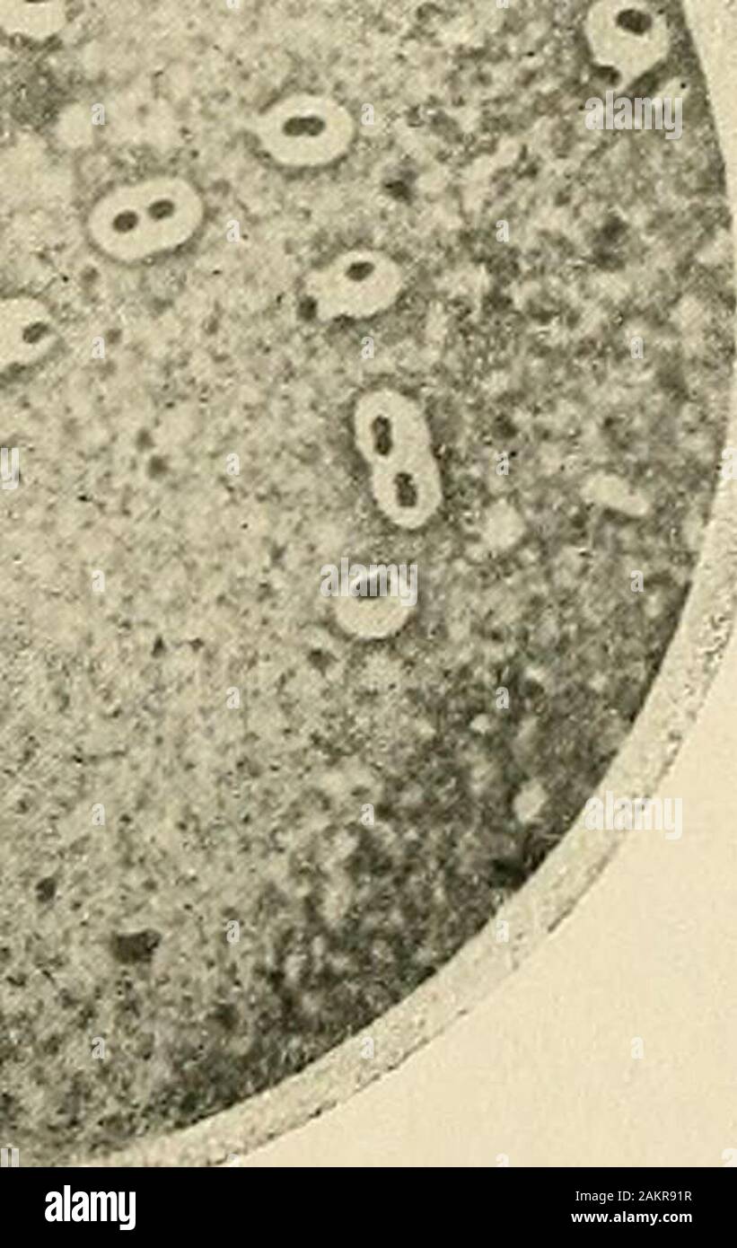 Diplococcus hi-res stock photography and images - Alamy