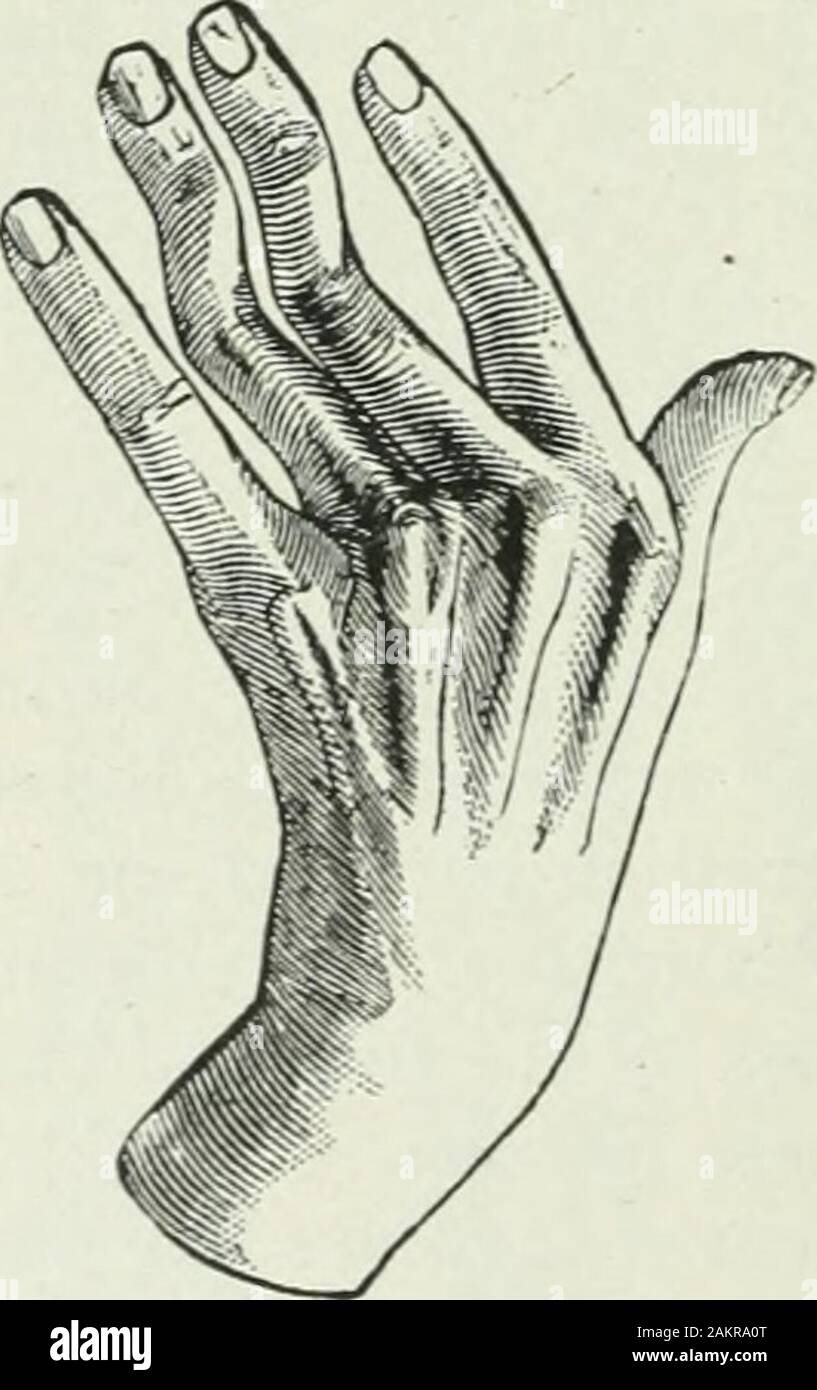 Applied anatomy and kinesiology; the mechanism of muscular movement ...