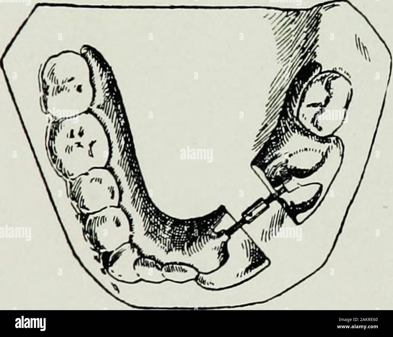 Facial deformity hi-res stock photography and images - Alamy