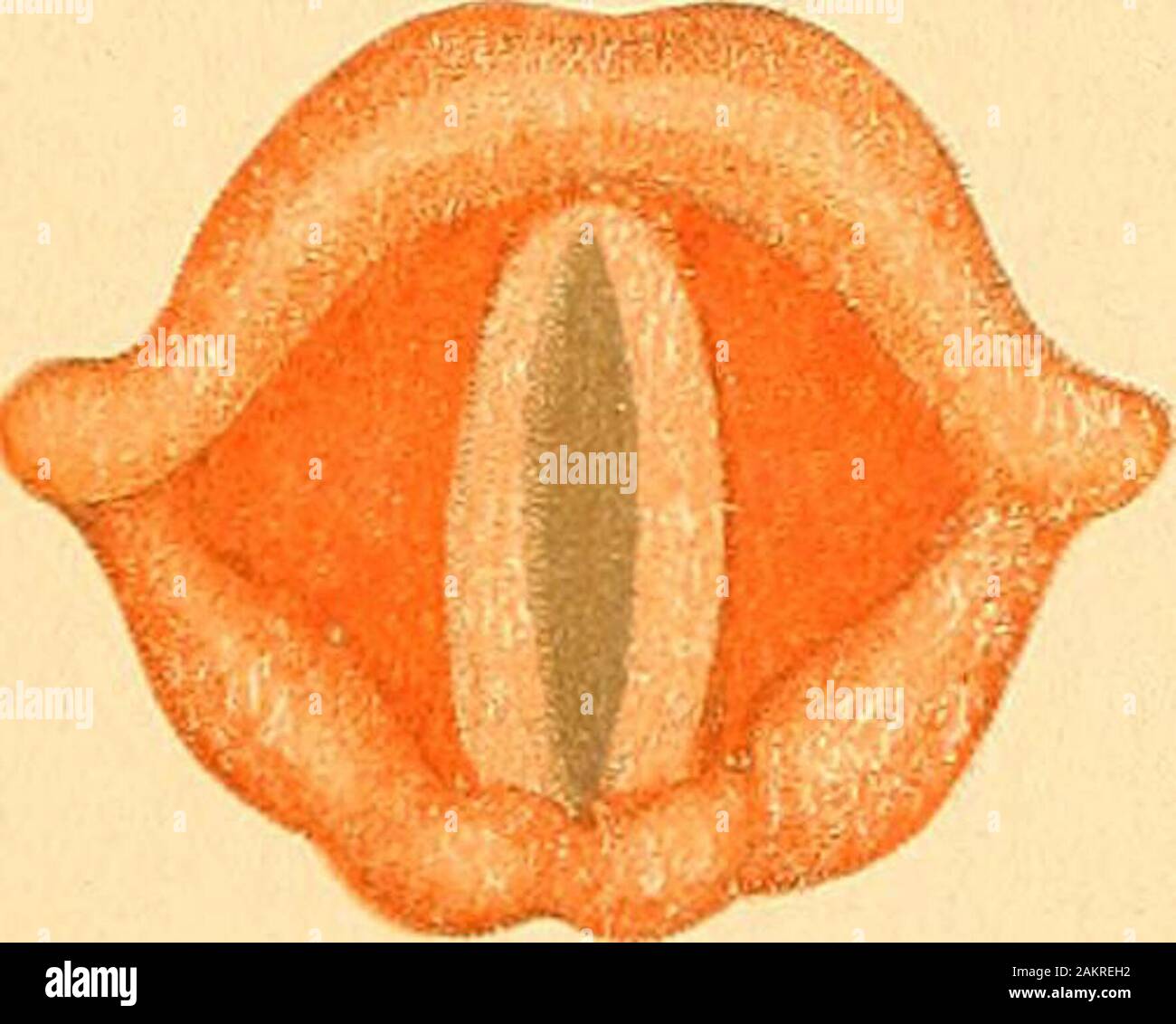 Severe laryngitis hi-res stock photography and images - Alamy