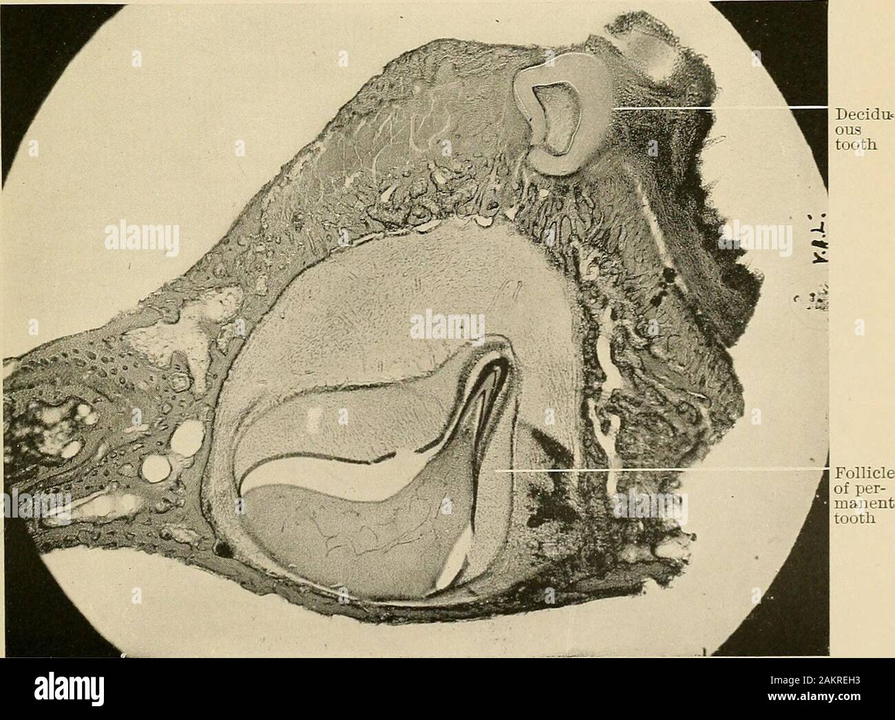 Principles and practice of operative dentistry . Follicle ofpermanent ...