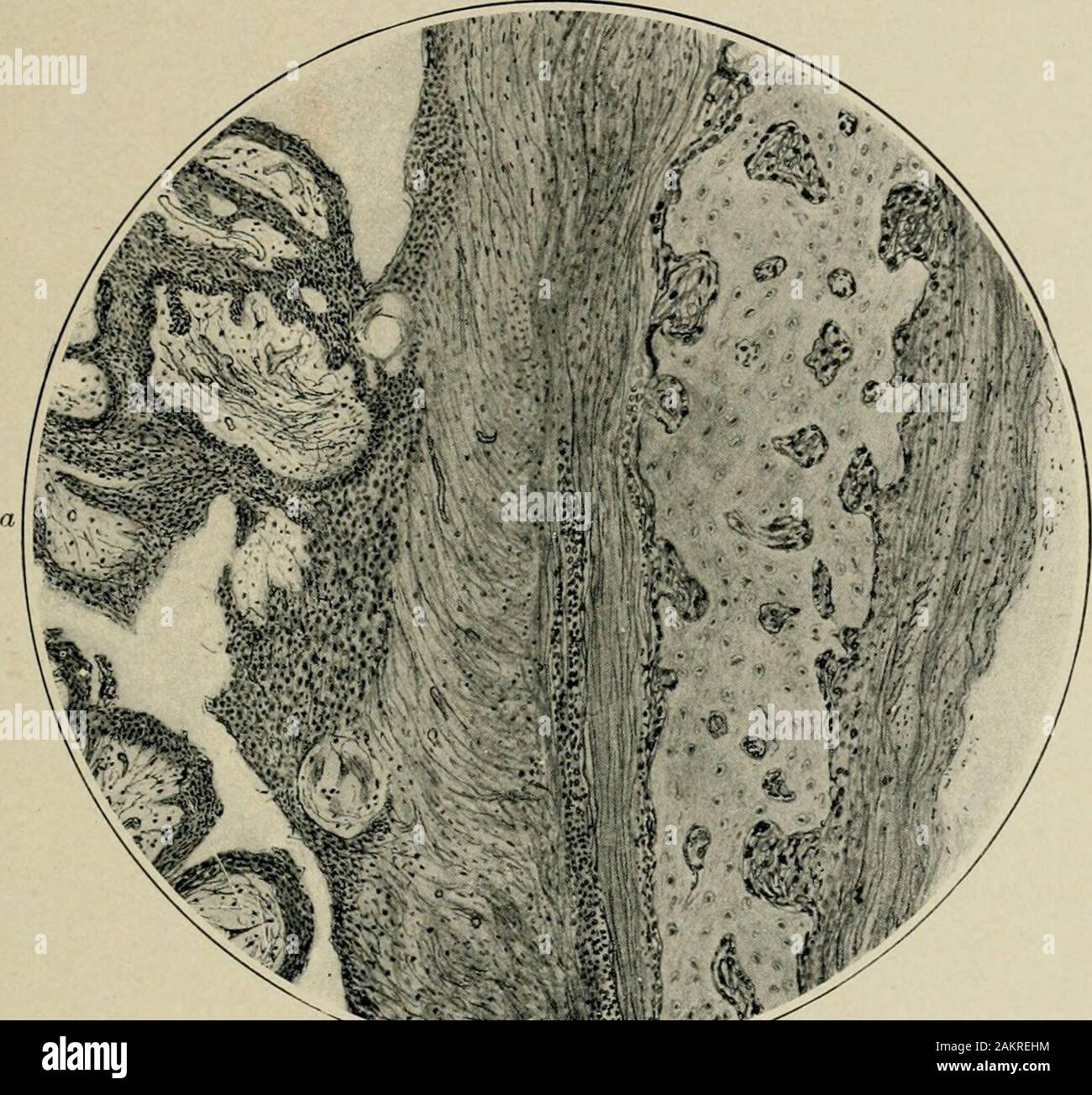 Full set of teeth hi-res stock photography and images - Alamy