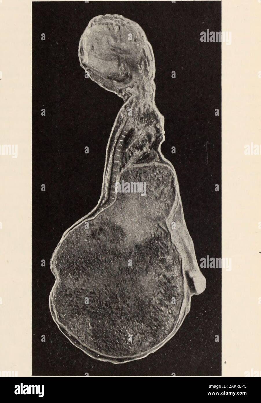 Outer cyst wall composed hi-res stock photography and images - Alamy