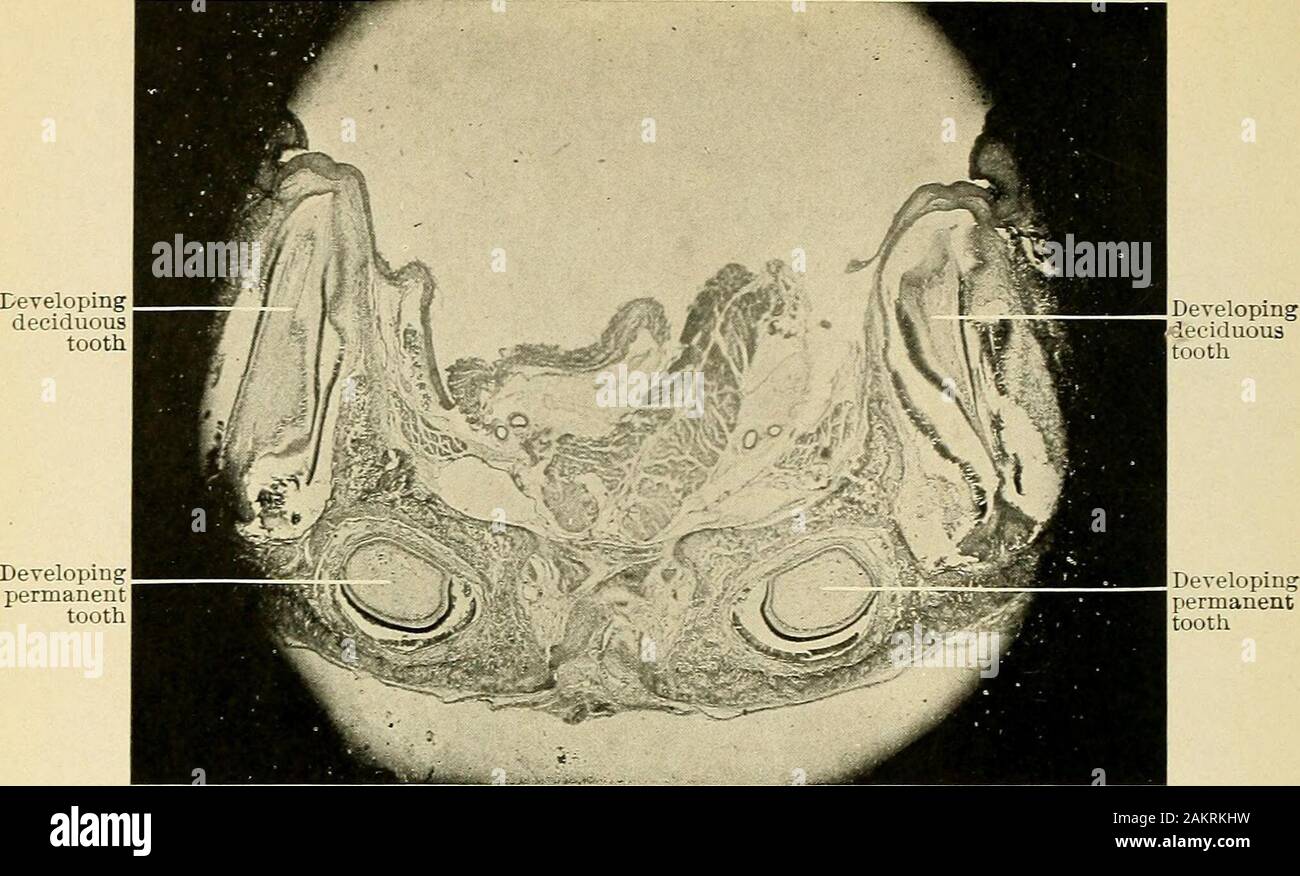 Principles and practice of operative dentistry . Perma-nenttooth ...