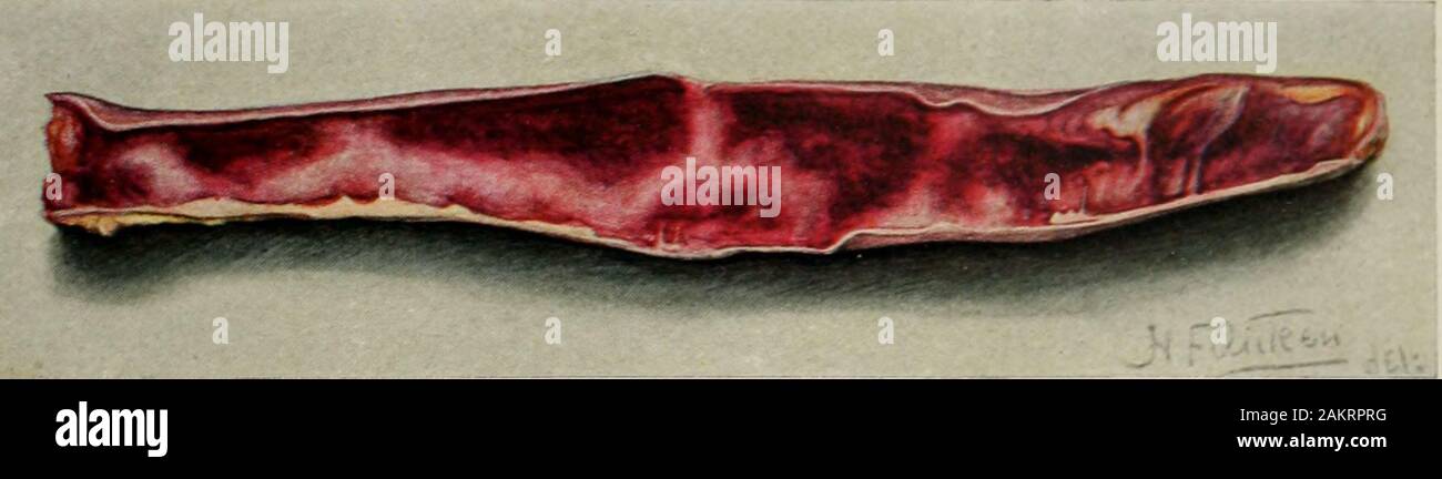 Determining bone science hi-res stock photography and images - Alamy