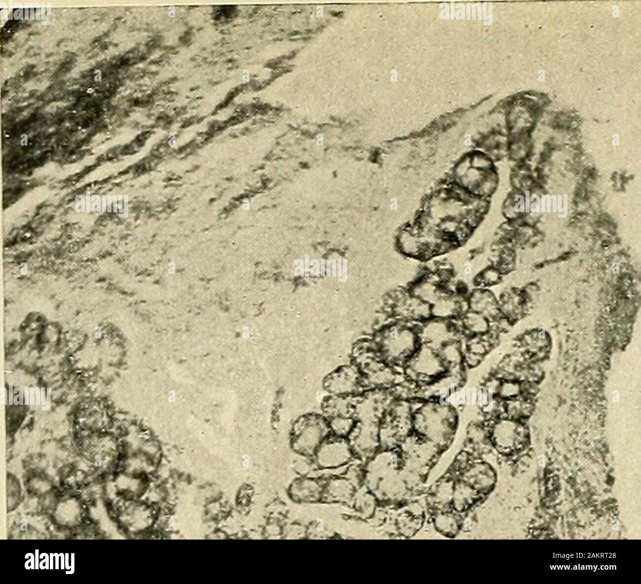 Dental follicle hi-res stock photography and images - Alamy