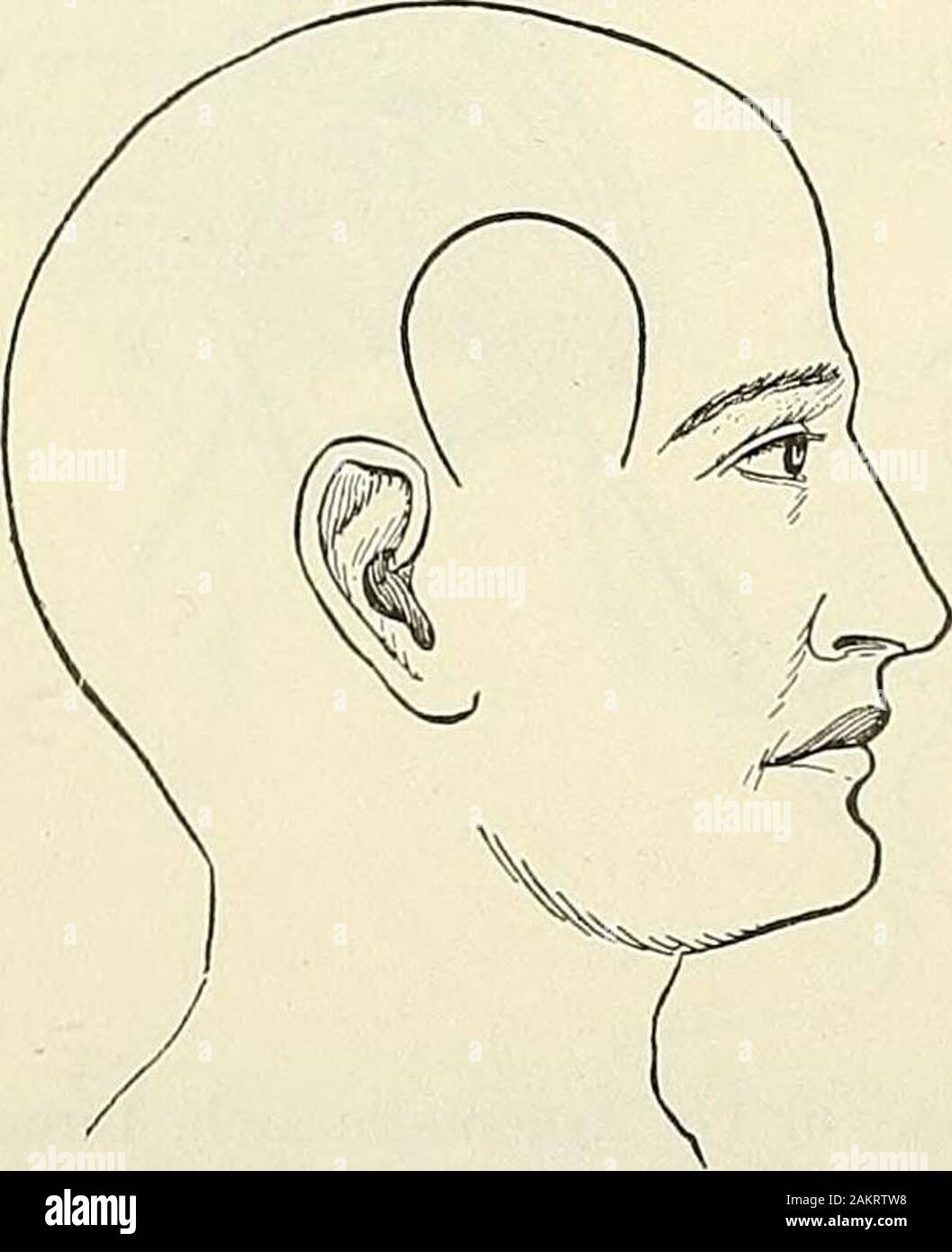 Modern surgery, general and operative . emorrhage. The patient is ...